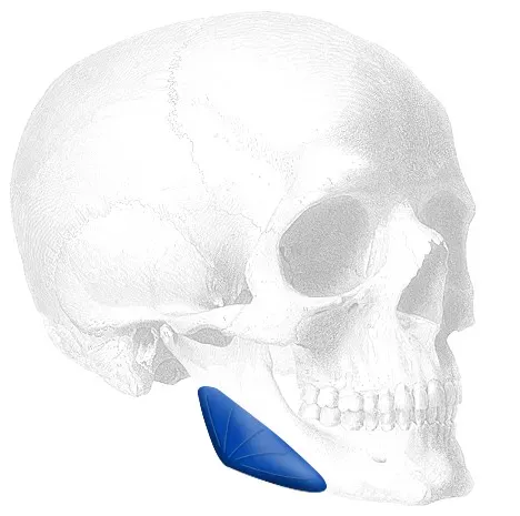 Widening Mandibular Angle – BOZZ Medical